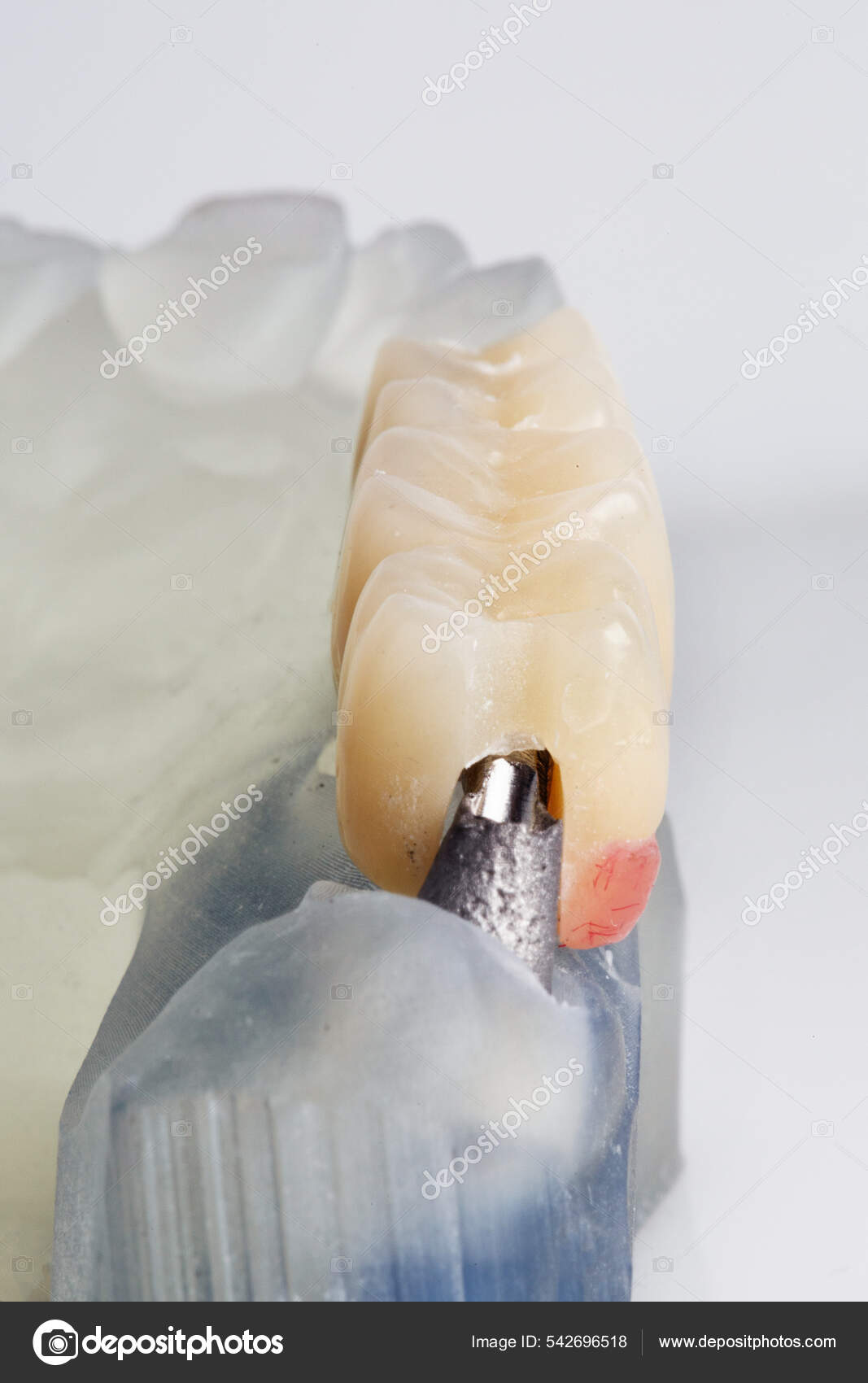 Temporary Dental Bridge Beam Chewing Teeth Shown Side Model White ...