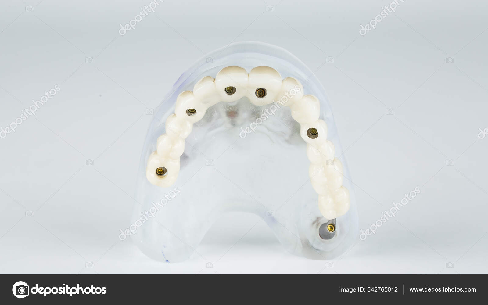 Denture Upper Jaw Model White Background View Chewing Part Stock Photo ...