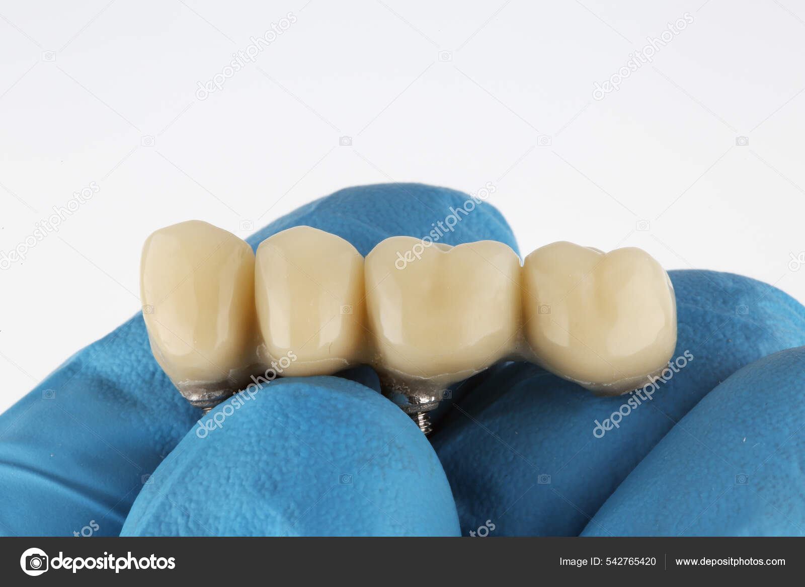 Excellent Temporary Dental Bridge Four Teeth Made Polymer Hand ...