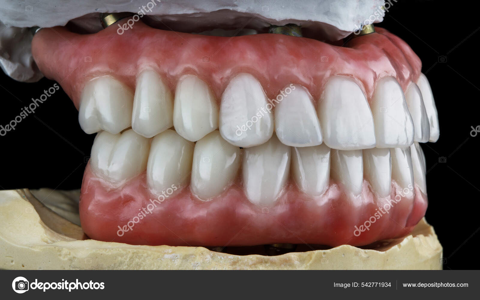Dental Dentures Lower Upper Jaws Dental Model Bite — Stock Photo ...