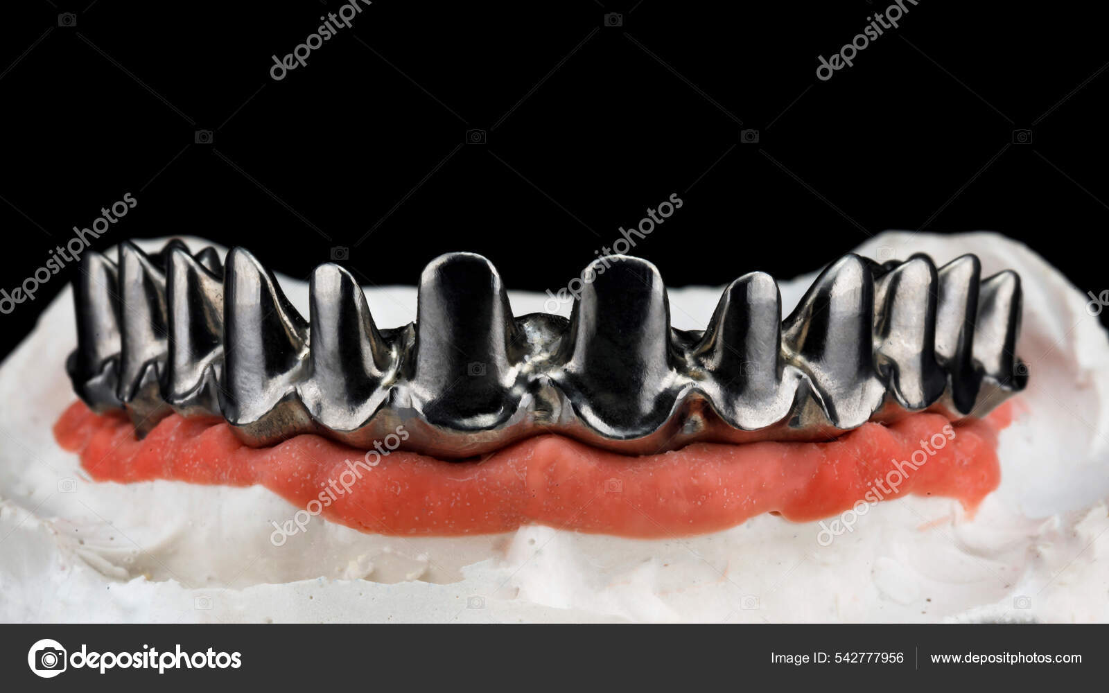 Titanium Beam Future Prosthesis Dental Model Gingival Plum — Stock ...