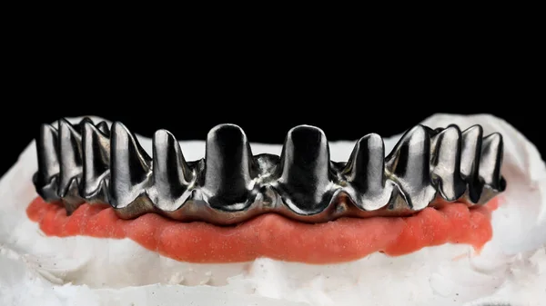 Titanium crowns Stock Photos, Royalty Free Titanium crowns Images ...
