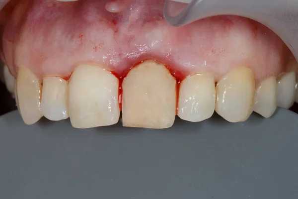 Full mouth restoration Stock Photos, Royalty Free Full mouth ...