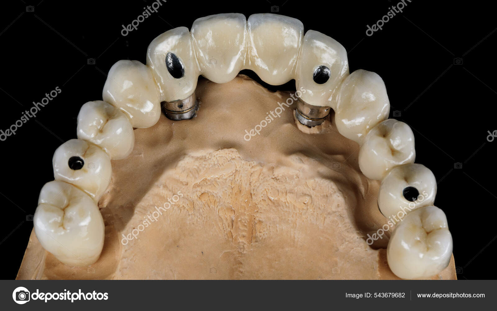 Metal Ceramic Prosthesis Upper Jaw Model Top View Black Background ...