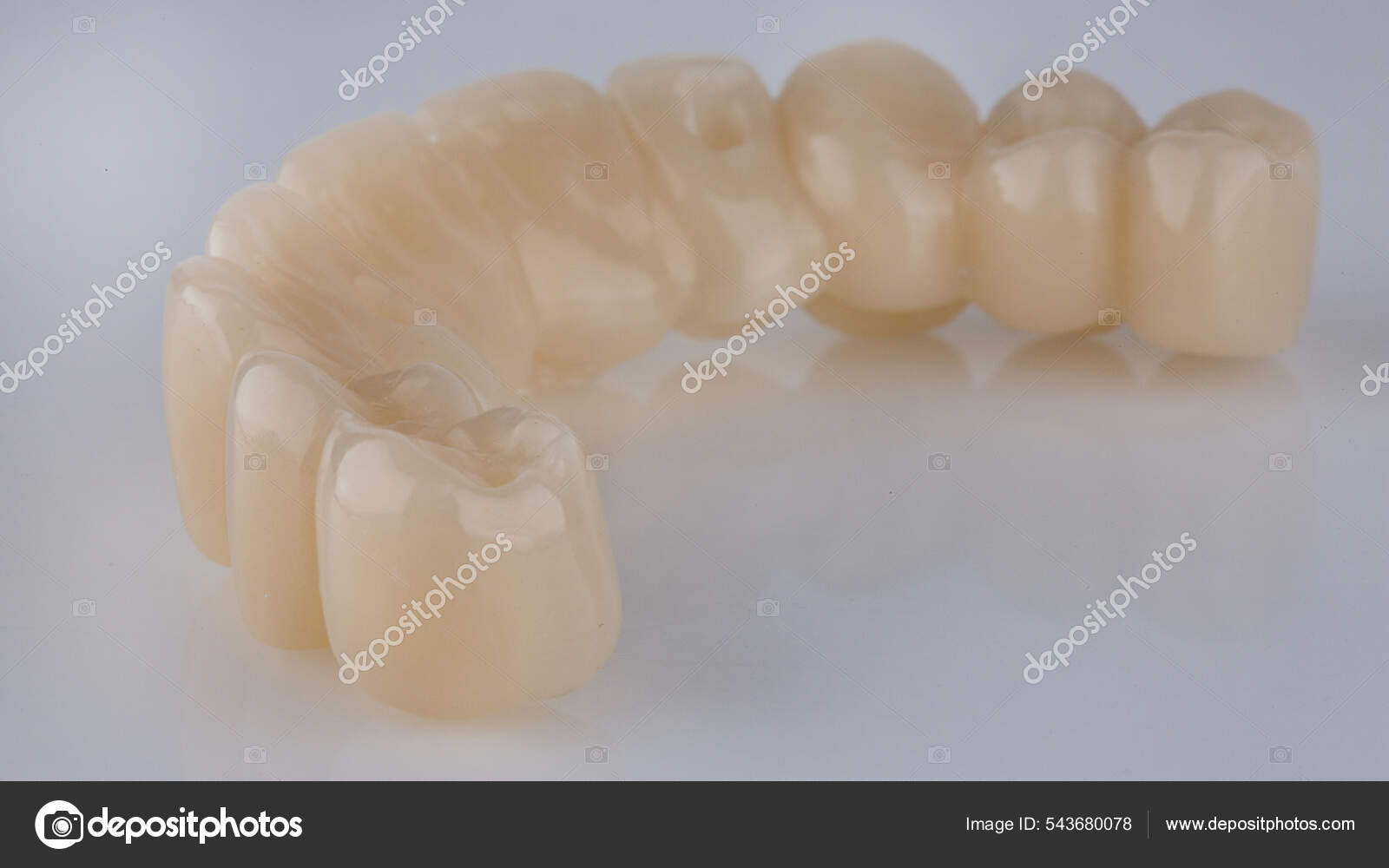 Temporary Prosthesis Upper Jaw Plastic View White Background — Stock ...