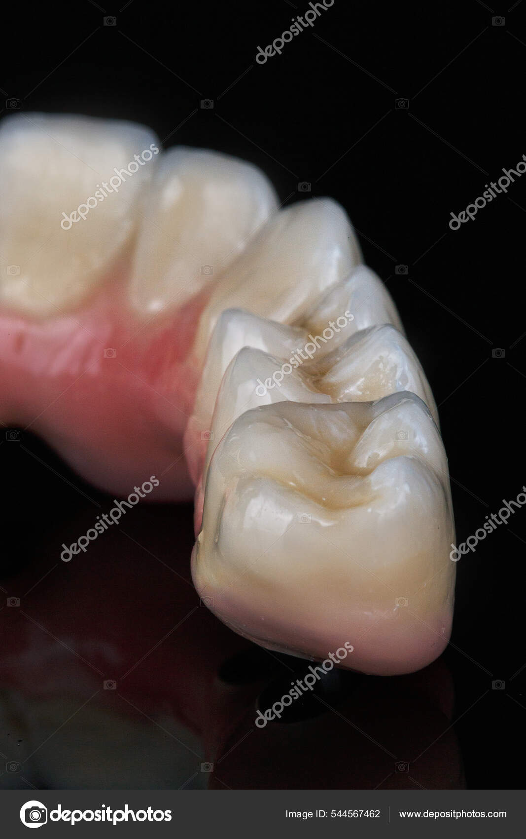 Anatomy Dental Prosthesis Chewing Teeth Black Background Stock Photo by ...